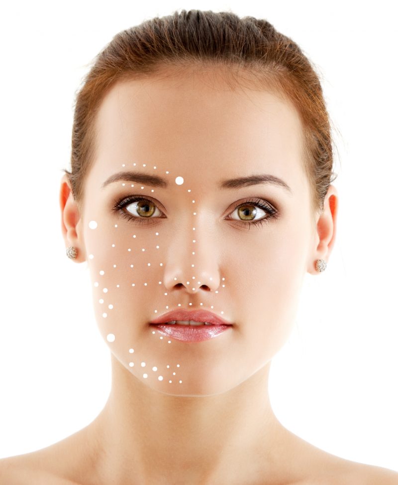 Microtox Microbotox - Injectors Club