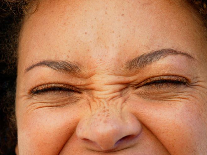 Botox para nariz especialista - Injectors Club